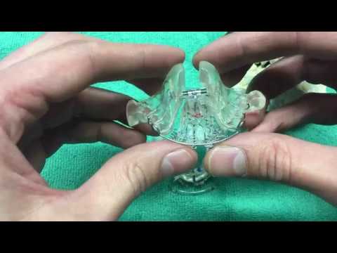 What is a DNA Appliance? - This will cure my sleep apnea! - YouTube