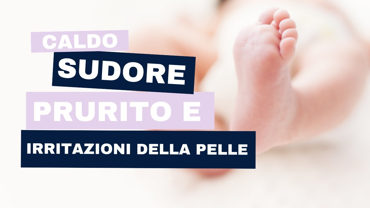 Conosci la sudamina? - YouTube