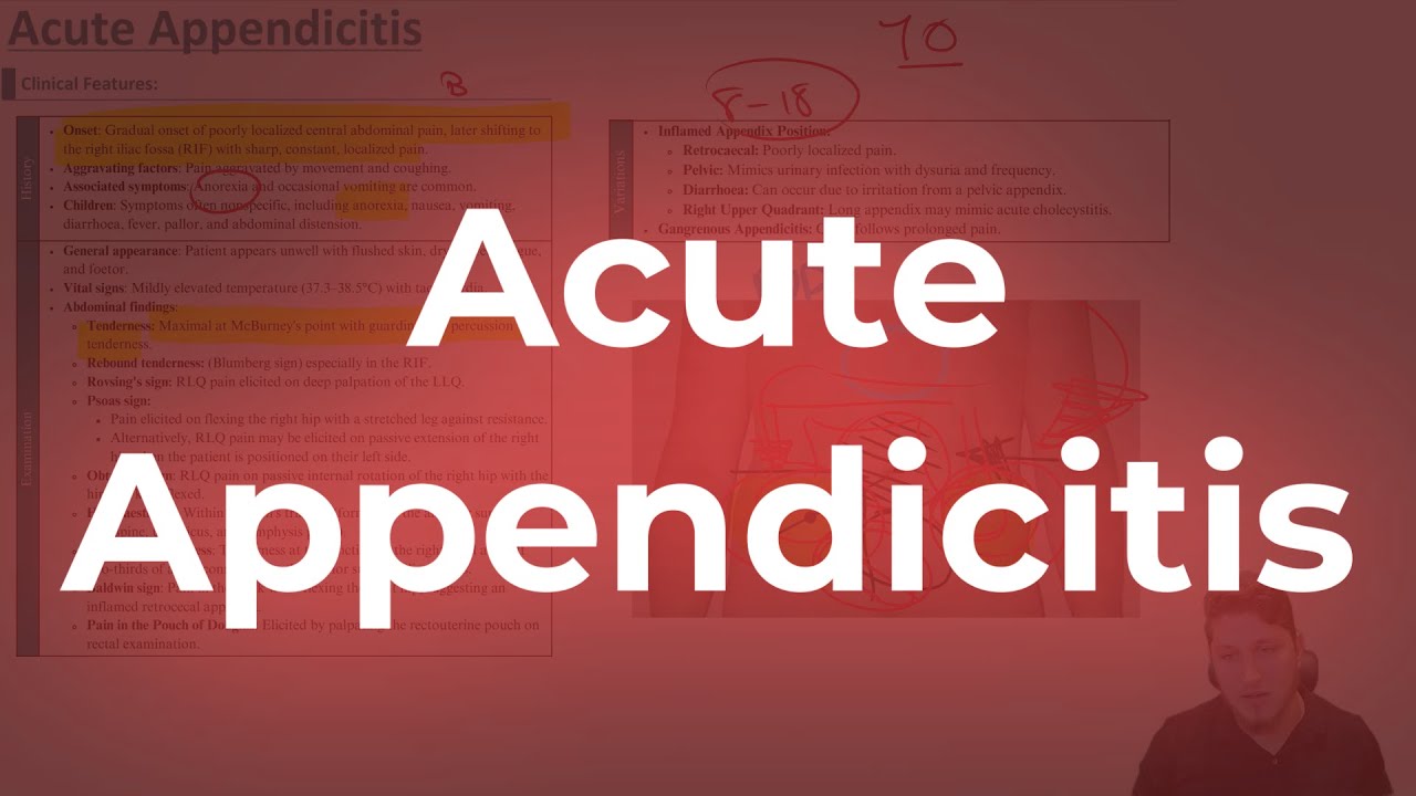 Acute Appendicitis | Comprehensive Surgery Course - YouTube
