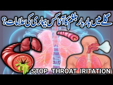 The 3 Causes of Constant Mucus || Phlegm in Your Throat || Dr. Kashif ...