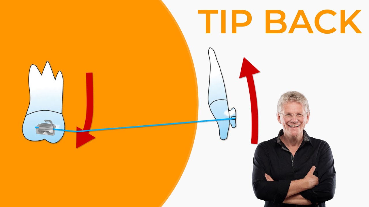 EFFECTIVE Orthodontic Tools - TIP BACK for beginners - @csorthoschool ...