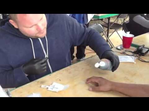 RFID chip implanted in human - LIVE - YouTube