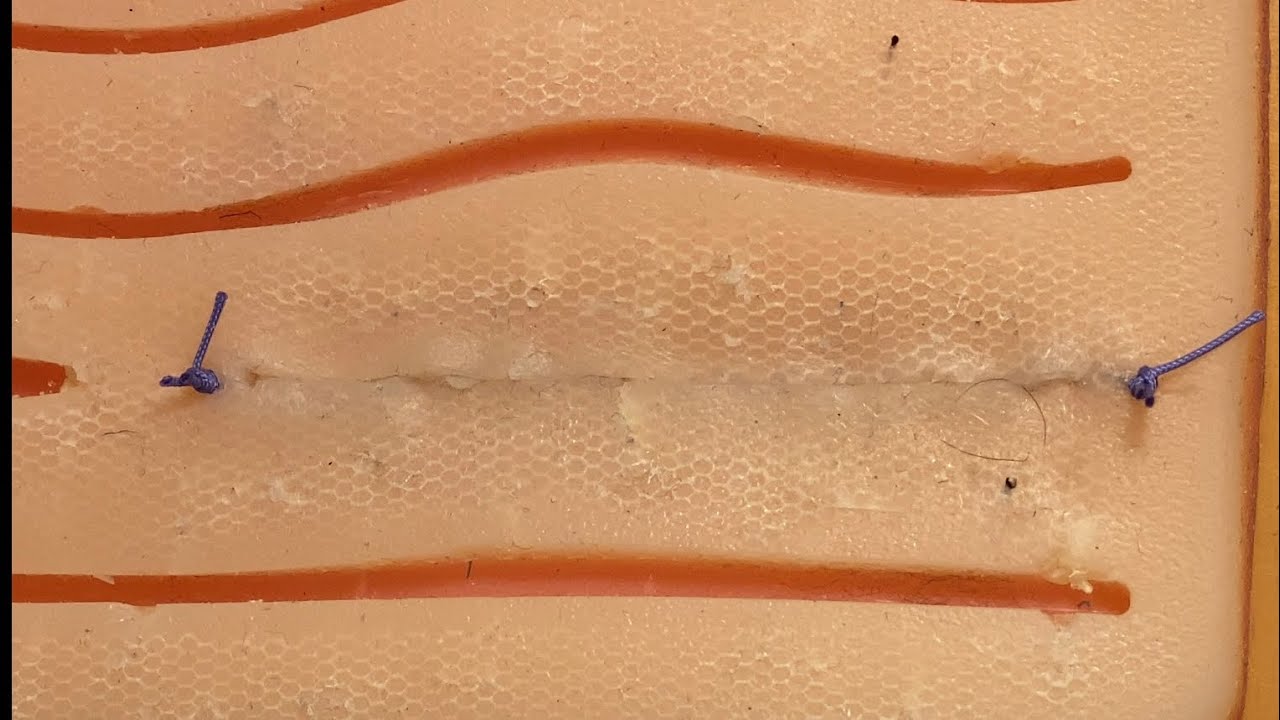 PUNTO INTRADERMICO TUTORIAL - YouTube