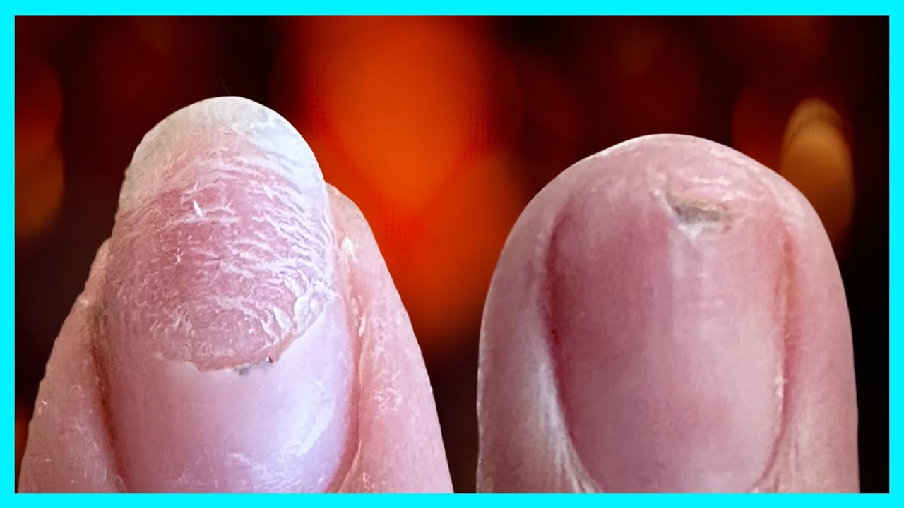 🛑STOP DAMAGING Your Natural Nails! TRY My Proven Technique - YouTube