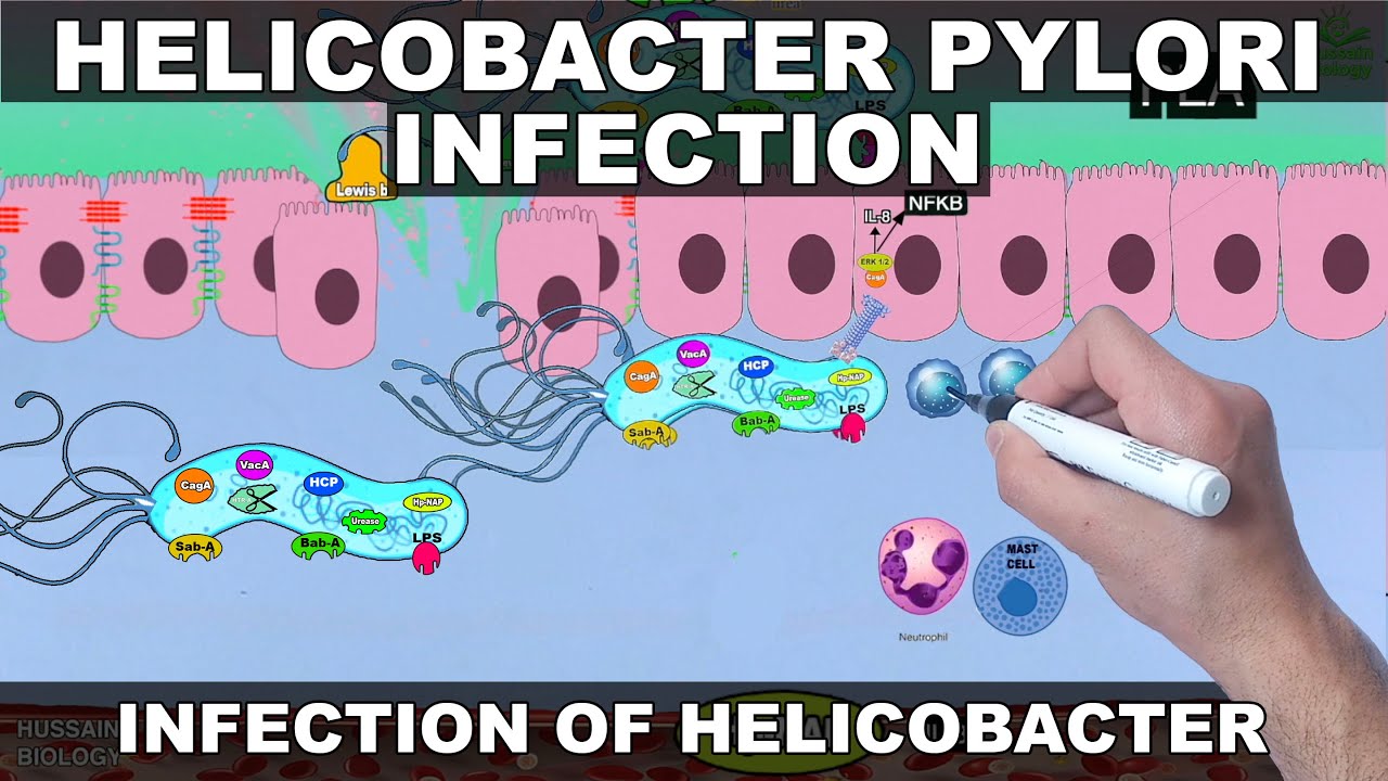 Helicobacter Pylori Pathogenesis | Detailed - YouTube