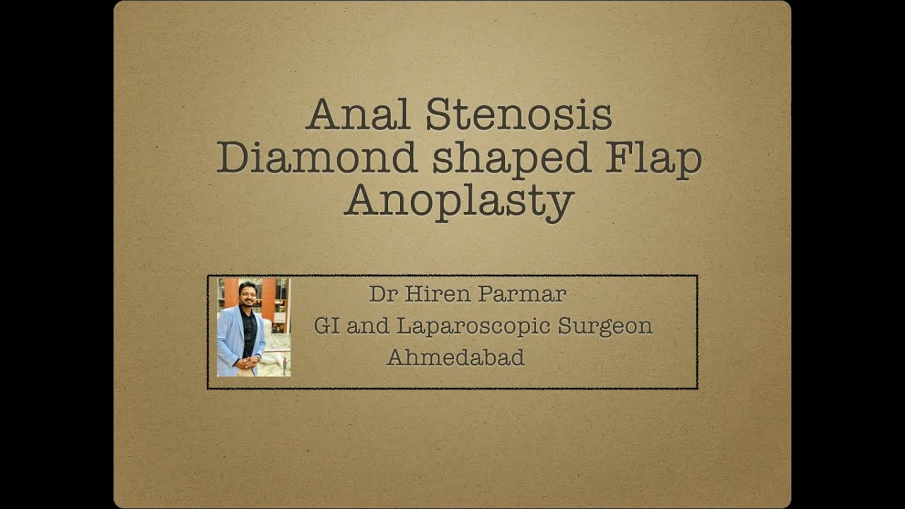 Anal Stenosis- Diamond flap Anoplasty - YouTube