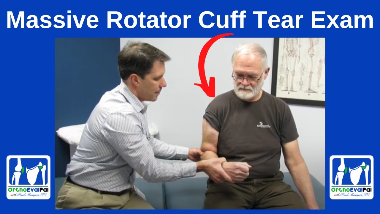 Massive Rotator Cuff Tear (PT Exam) - YouTube