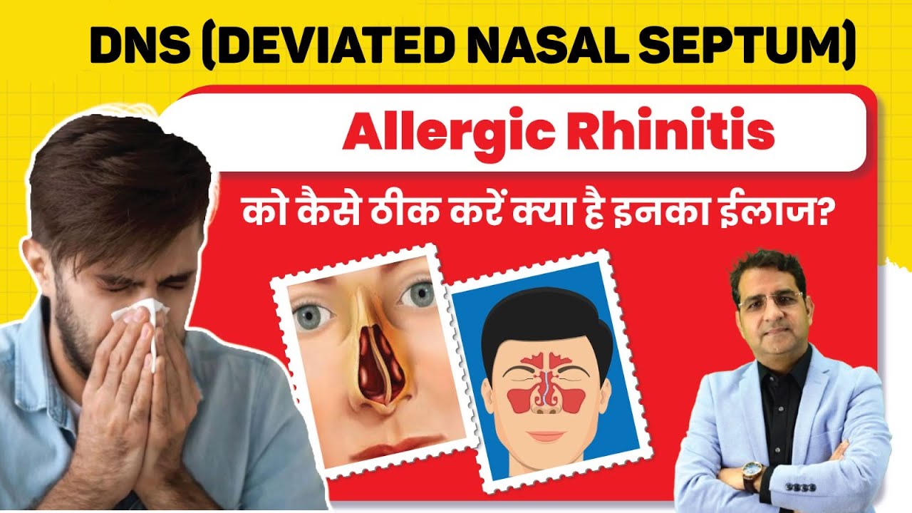 DNS(Deviated Nasal Septum) और Allergic rhinitis क्या होता हैं? जानिए ...