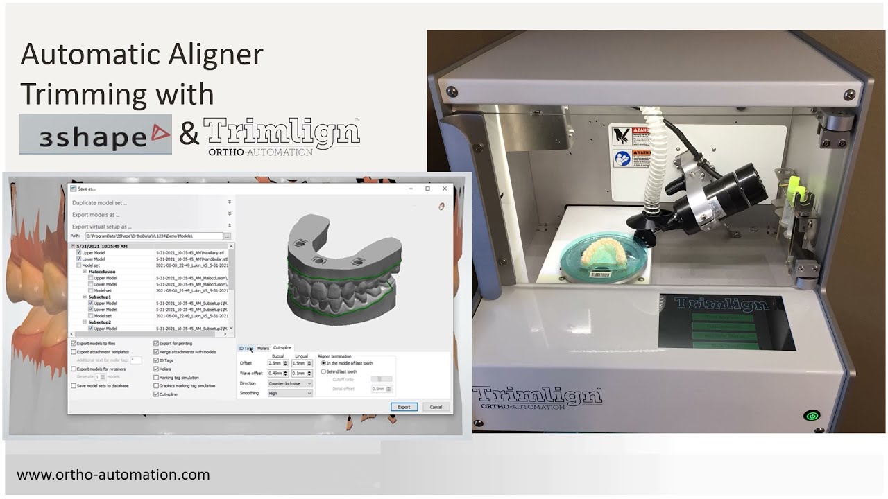 Automatic aligner trimming with 3Shape and Trimlign - YouTube