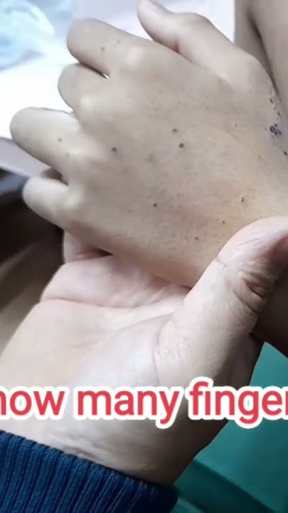 how many fingers do you have? - YouTube