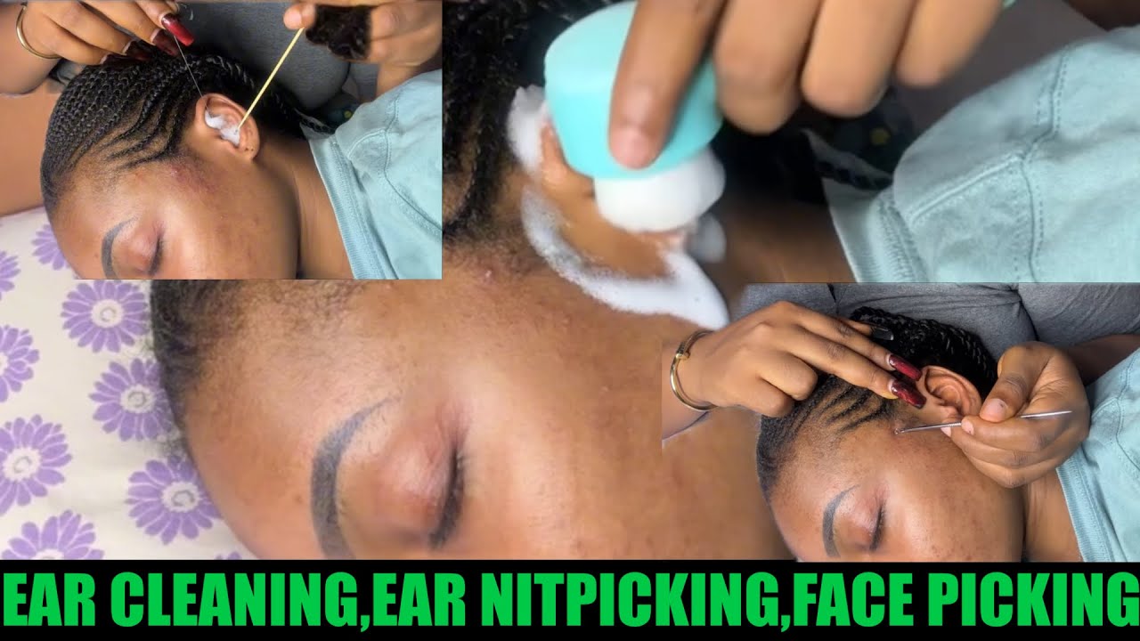 Asmr Intense Ear Cleaning,Ear Nitpicking,Face Picking,Ear Massage With ...