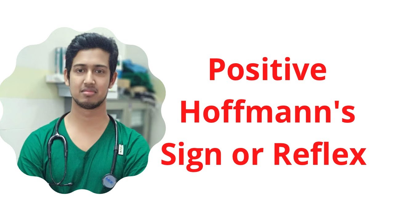 Hoffmann's Sign or Reflex || Upper Motor Neuron Lesion - YouTube