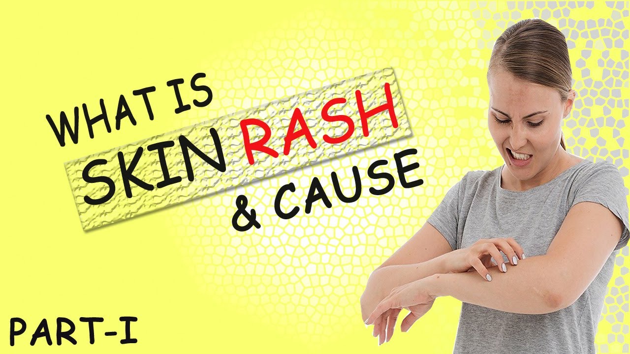 Skin rashes sign symptoms and cause| त्वचा के रोग और कारण what is skin ...