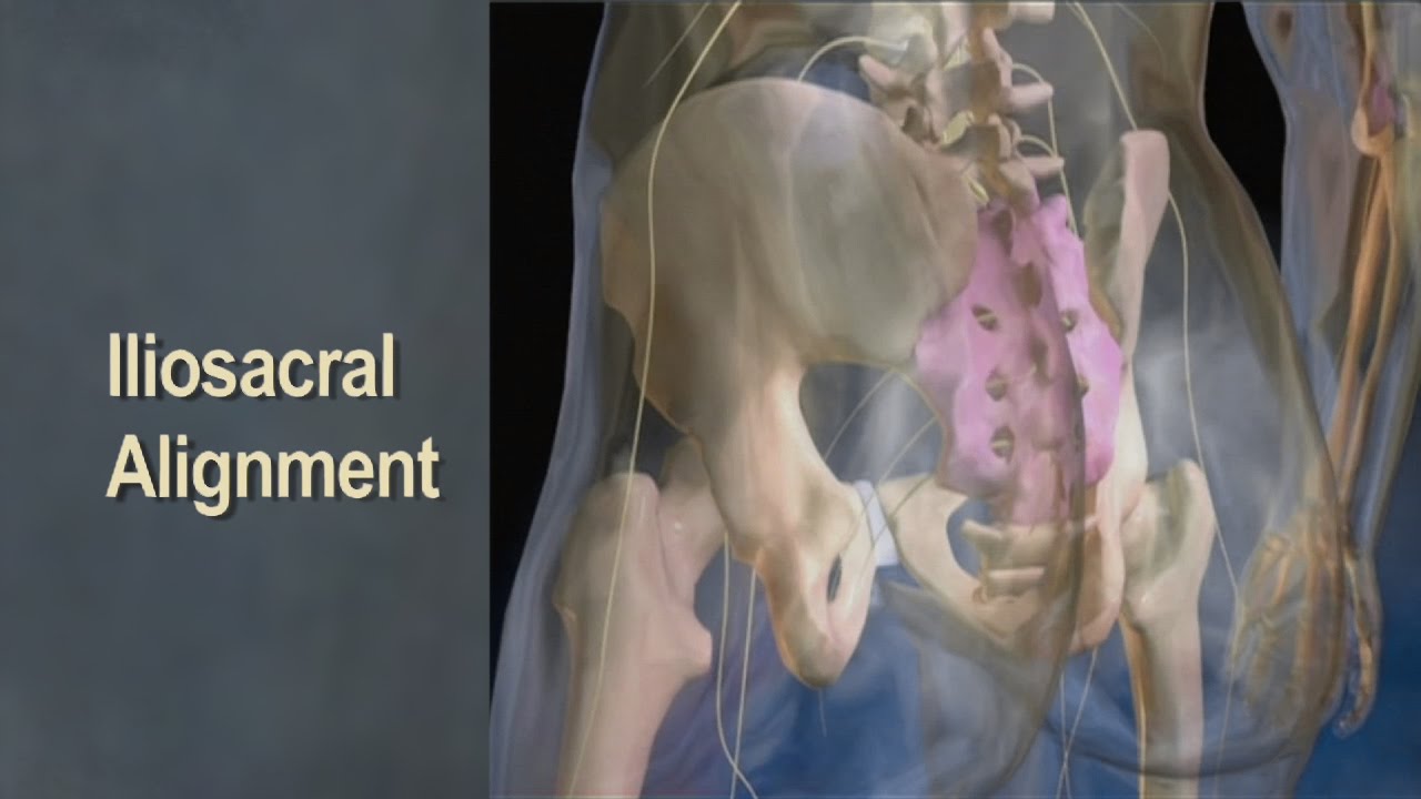 Iliosacral Alignment Technique to Level the Sacral Base - YouTube