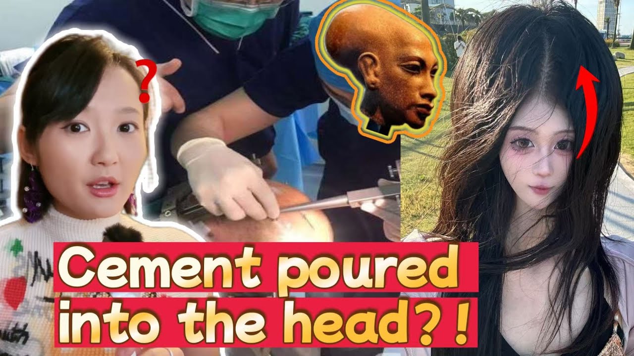 Deadly Beauty Trend: Girls Are Pouring Cement Into Their Heads in China ...