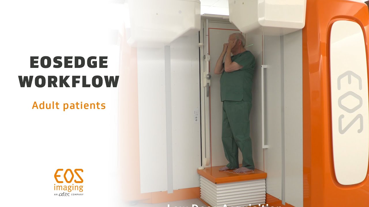 EOSedge workflow (adult) - YouTube