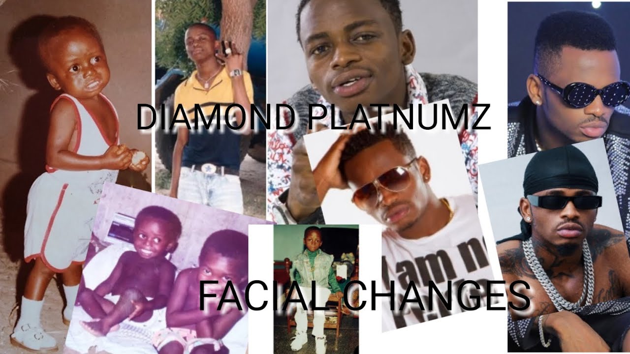 DIAMOND PLATNUMZ TRANSFORMATION: how Diamond's face changed, From when ...