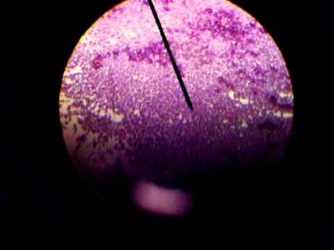 STAPHYLOCOCCUS EPIDERMIDIS--GRAM STAINED - YouTube