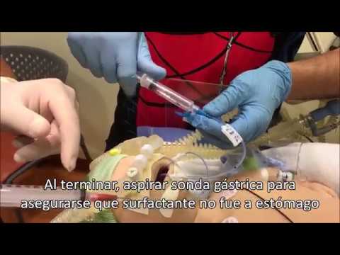 Surfactante Mínimamente Invasivo - Técnica LISA - YouTube