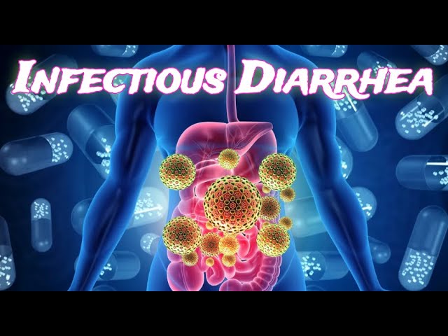 Infectious Diarrhea Causes Infectious Diarrhea Hi Res Stock