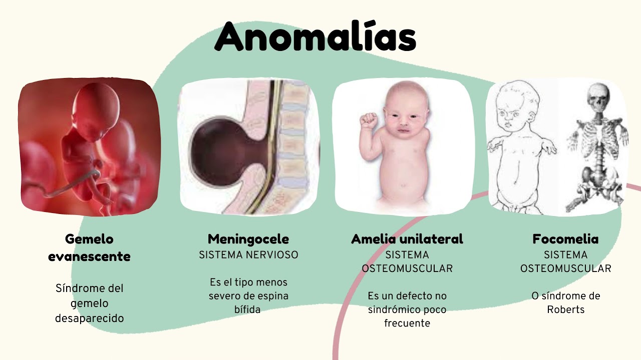 Anomalías en el Desarrollo Embrionario - YouTube