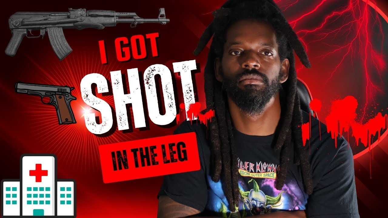 They shot me in my leg!!! WTF - YouTube