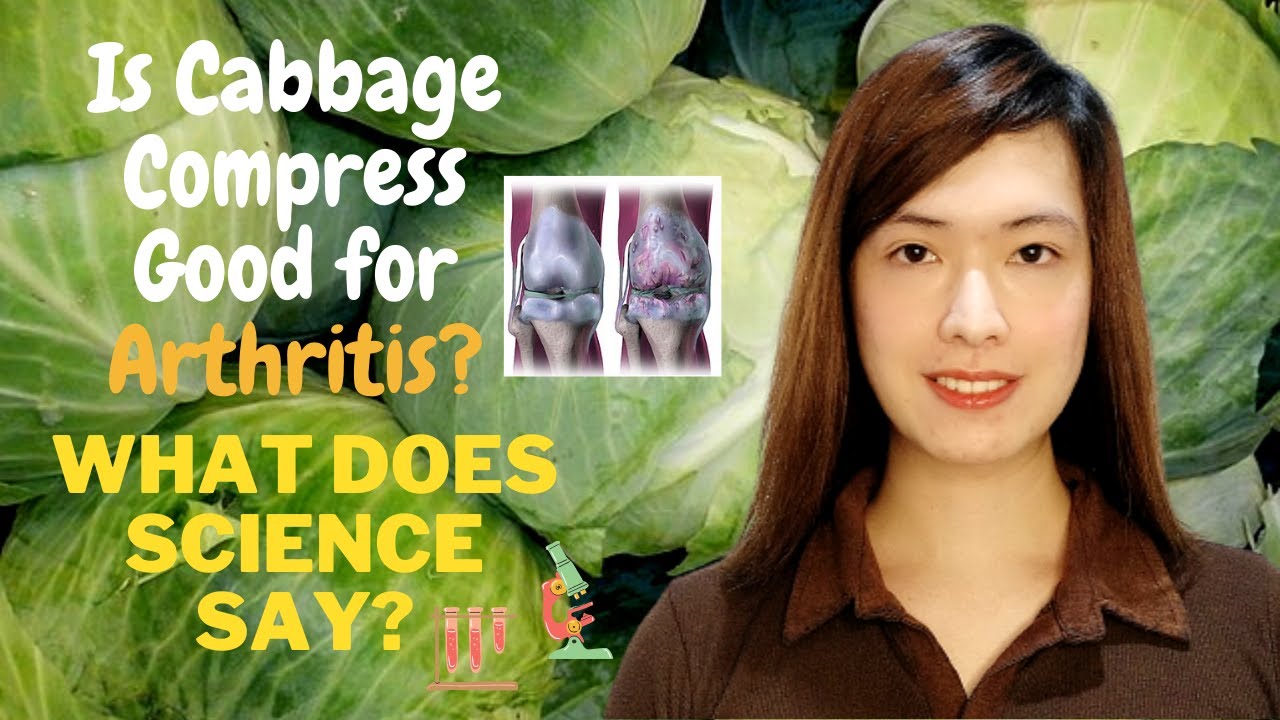 Is Cabbage Compress Good for Arthritis? What Does Science Say? - YouTube