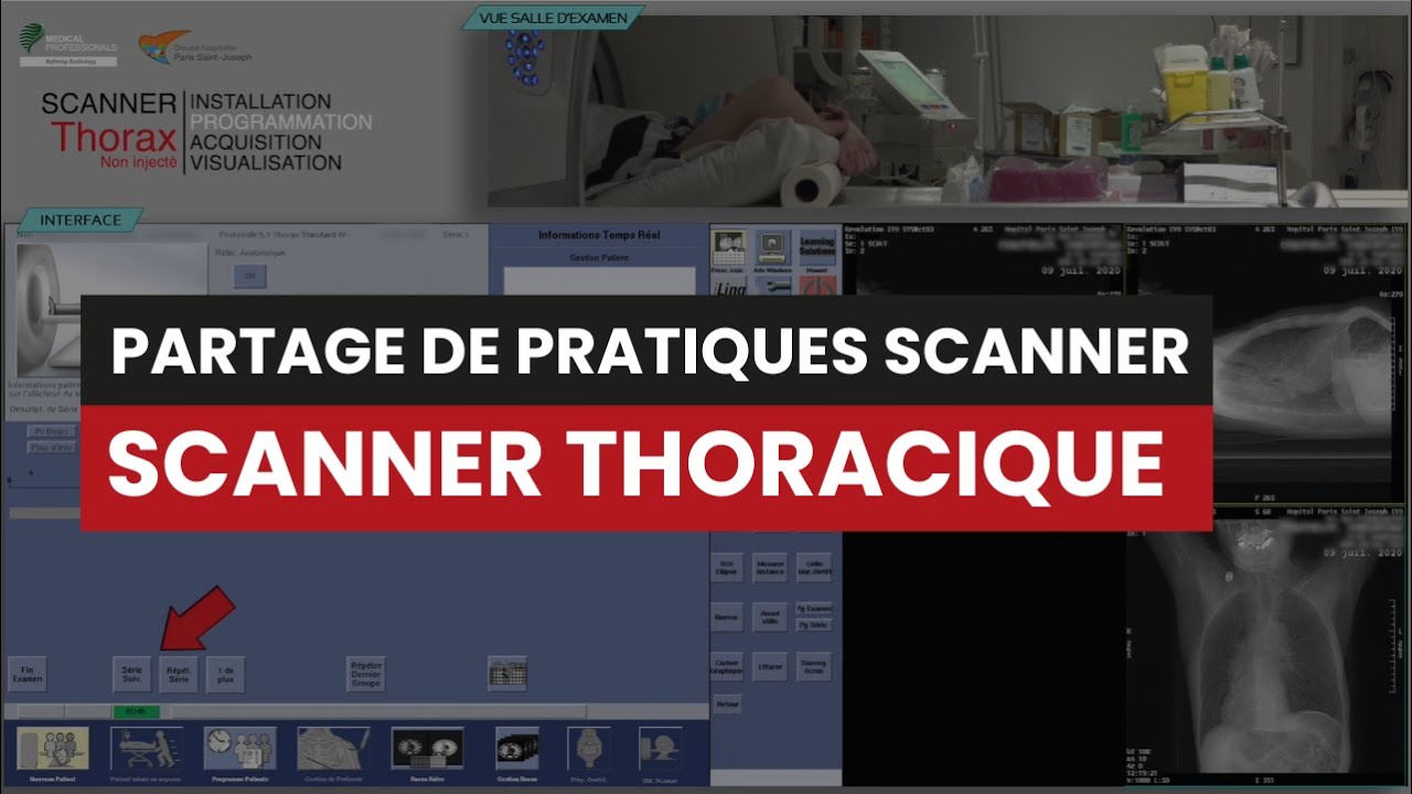 CT Scanner THORACIQUE (Sans Injection) - Partage de Pratiques - YouTube