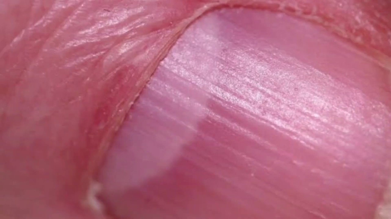 The lunula facts in hindi (explained) - YouTube