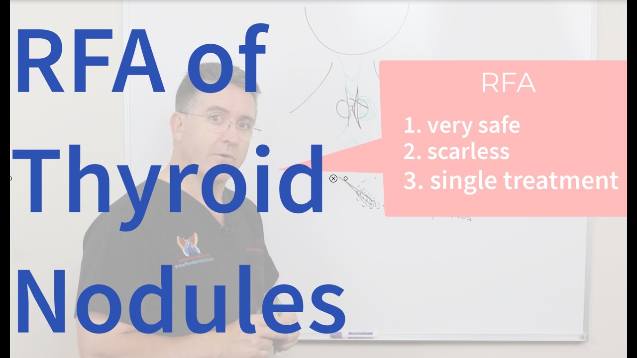 RFA - A New Alternative to Thyroid Surgery - YouTube