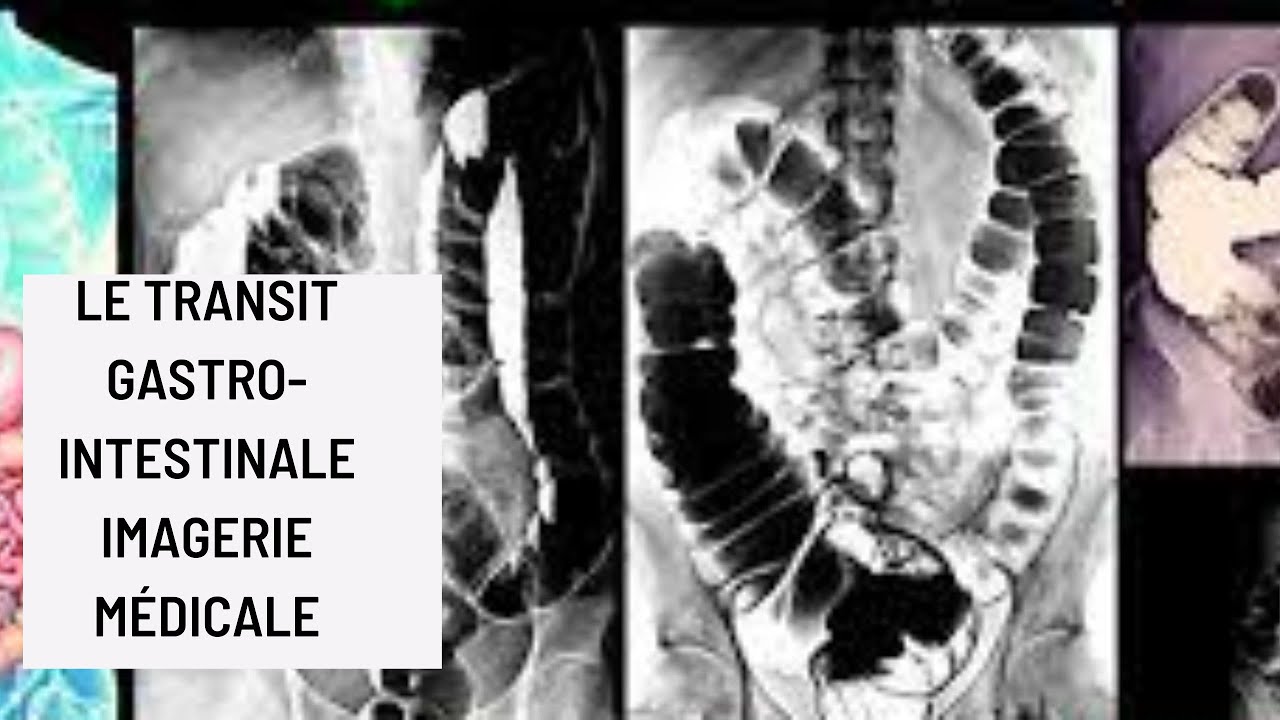 Le transit gastro-intestinale Imagerie médicale - YouTube