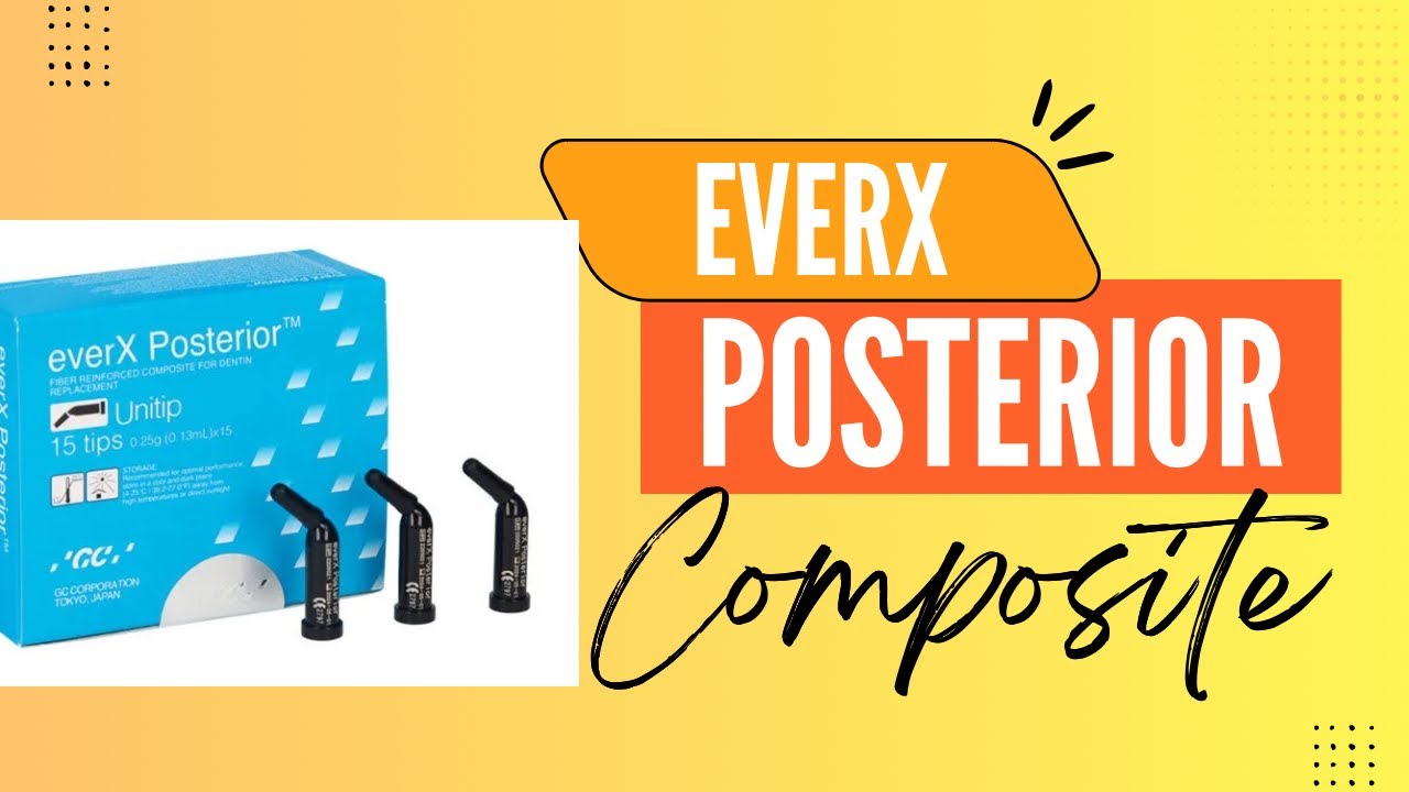 EVERX POSTERIOR | SHORT FIBER REINFORCED COMPOSITES | SFRC | COMPOSITES ...