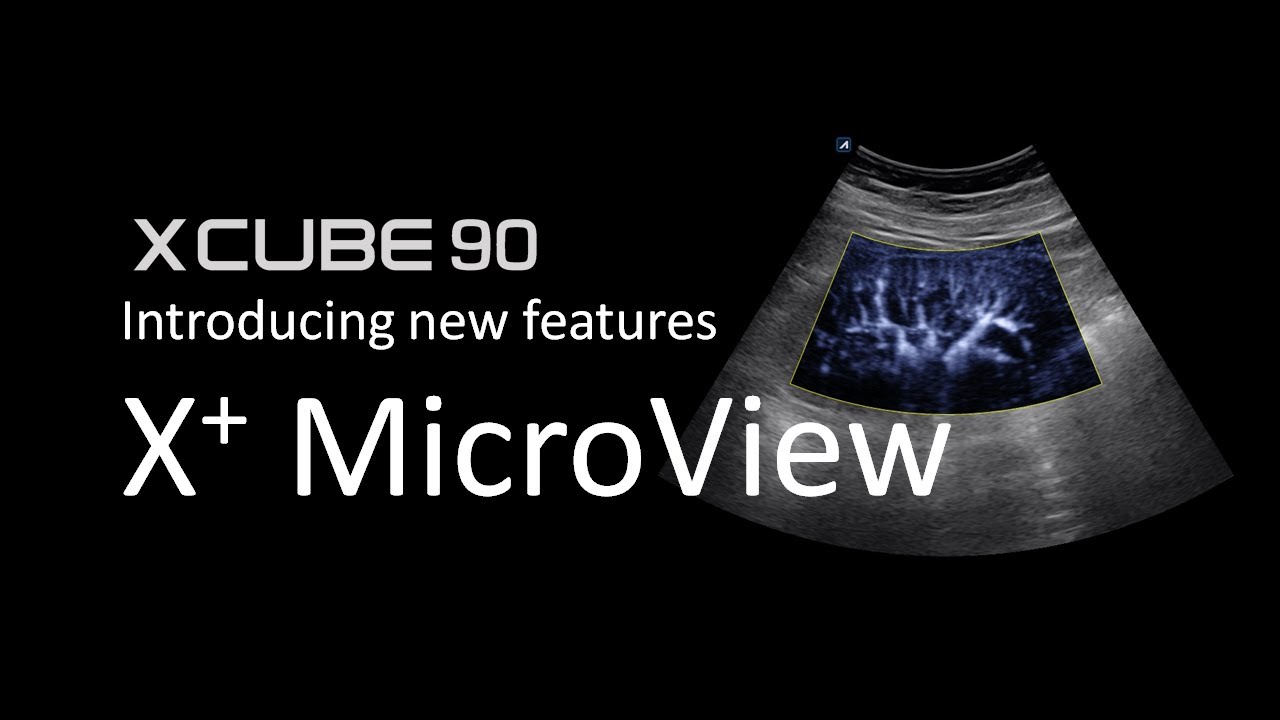 X-CUBE 90 New Features: X+ MicroView - YouTube