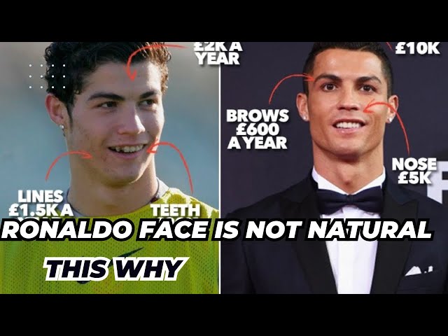 Cristiano Ronaldo Transformation Face Cristiano Ronaldo Before And