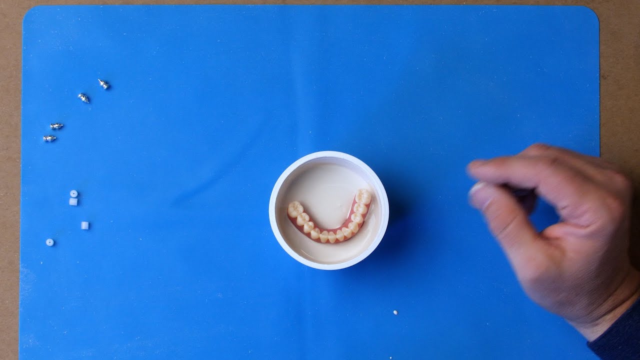 Create a Master Cast - Smart Denture Conversions Training - YouTube