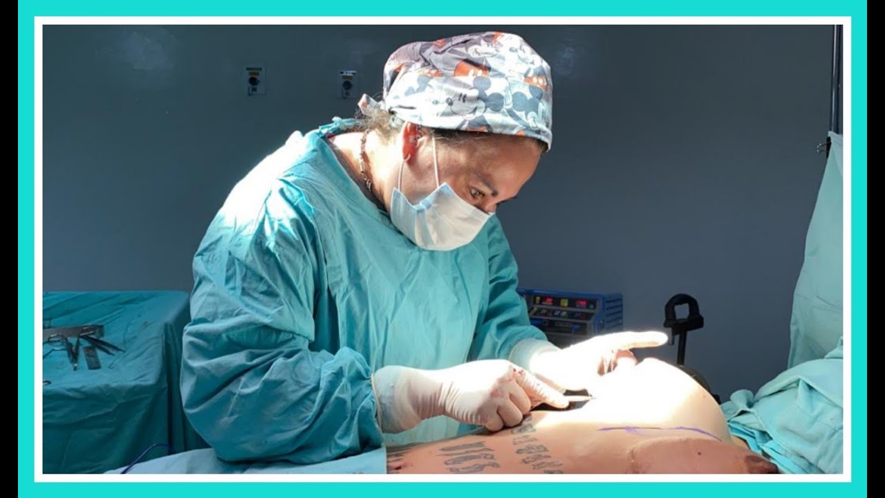 PEXIA SECUNDARIA CON RECAMBIO DE IMPLANTES | Procedimiento 😱🍒 | Dra ...