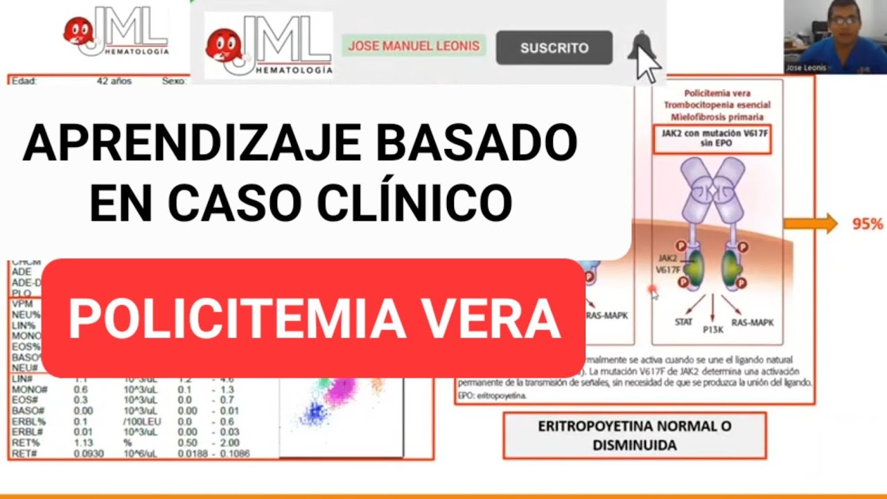 POLICITEMIA VERA. APRENDIZAJE BASADO EN CASO CLÍNICO. #medicina # ...