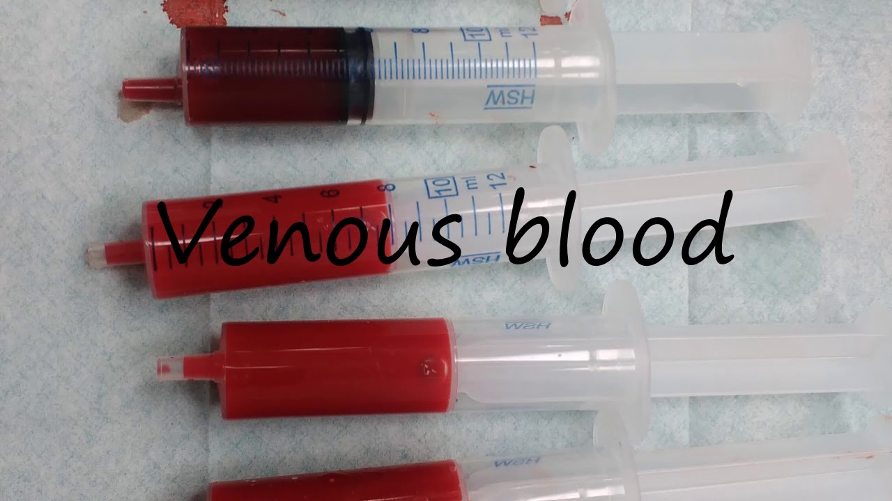 How to Pronounce Venous blood? - YouTube