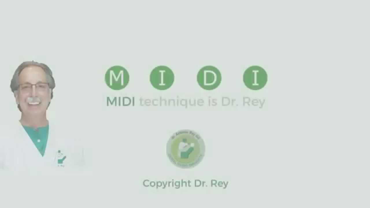 MIDI© Dr.REY Technique. IMPLANT SYSTEM - YouTube
