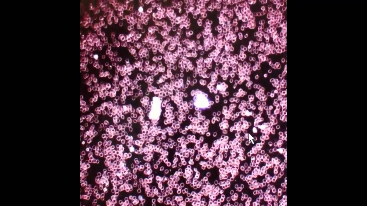 Dark Field Live Blood Analysis with Hologram - YouTube