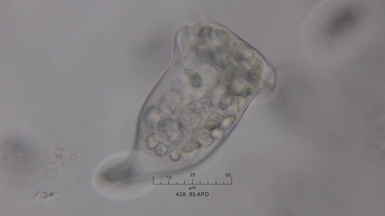 Pond Life Through the Microscope: Vorticella (Peritrich) 4 - YouTube
