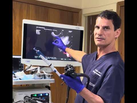 Ecoendoscopia (ultrassonografia endoscópica) com biópsia de lesão no ...