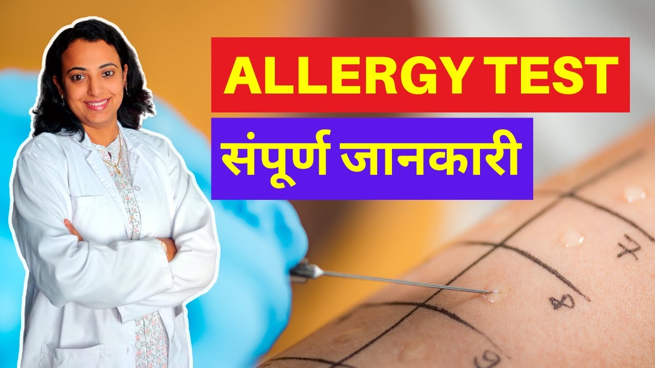 Allergy Test कैसे किया जाता हैं ? | How is Allergy Test Done? - YouTube