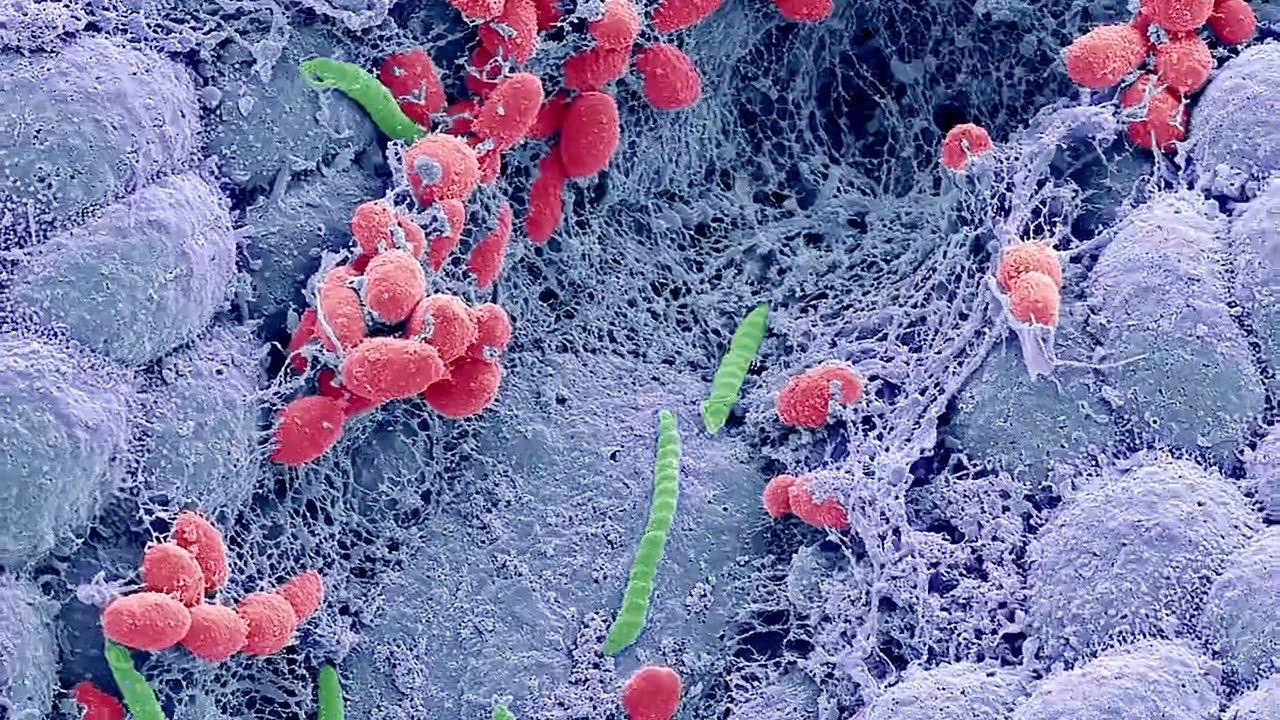 Researchers find surprising bacteria at high altitudes in the soil of ...
