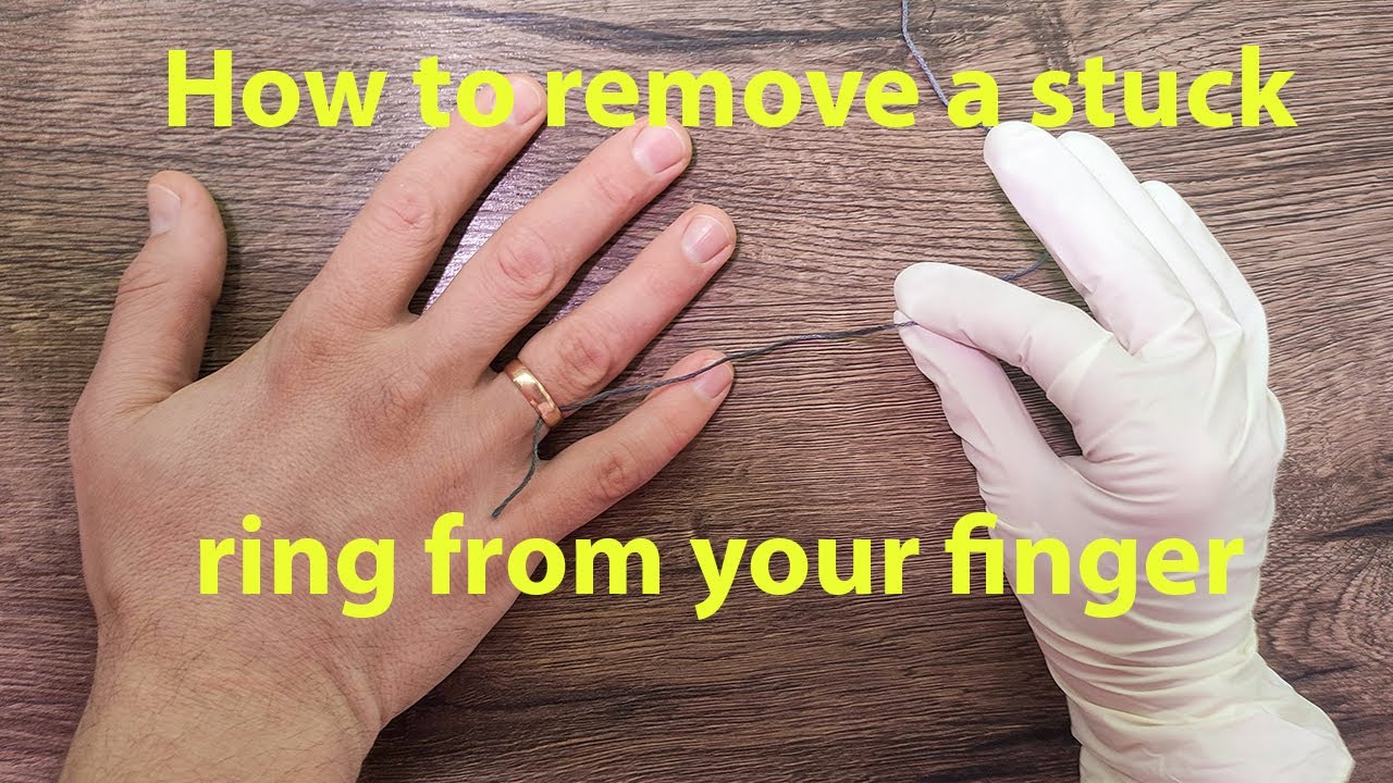 The doctor showed how to remove a stuck ring from a finger - YouTube