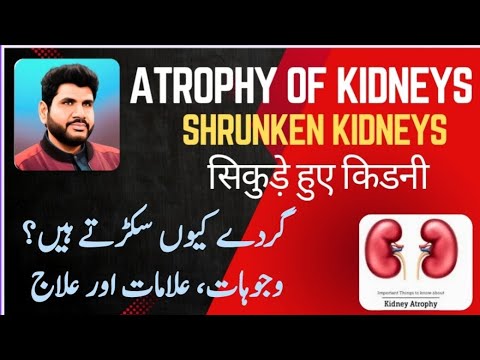 Are Your Kidneys Shrinking? Understand Atrophic Kidney Disease,सिकुड़े ...