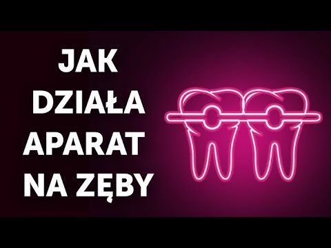 Jak działa aparat na zęby (i dlaczego tak wolno)