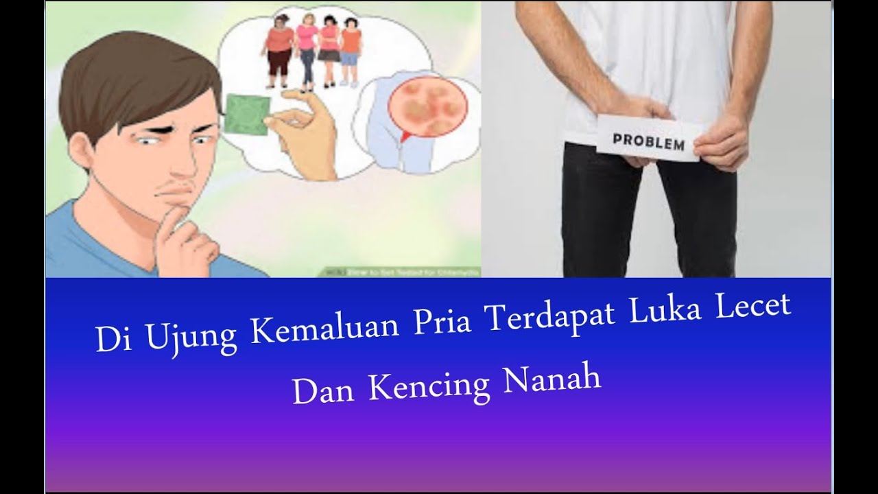 di ujung kemaluan pria terdapat luka lecet dan kencing nanah - YouTube