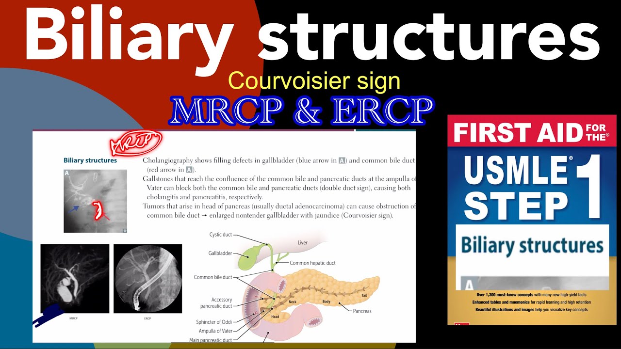 Biliary structures, Courvoisier sign, ERCP & MRCP in Hindi/Urdu by ...