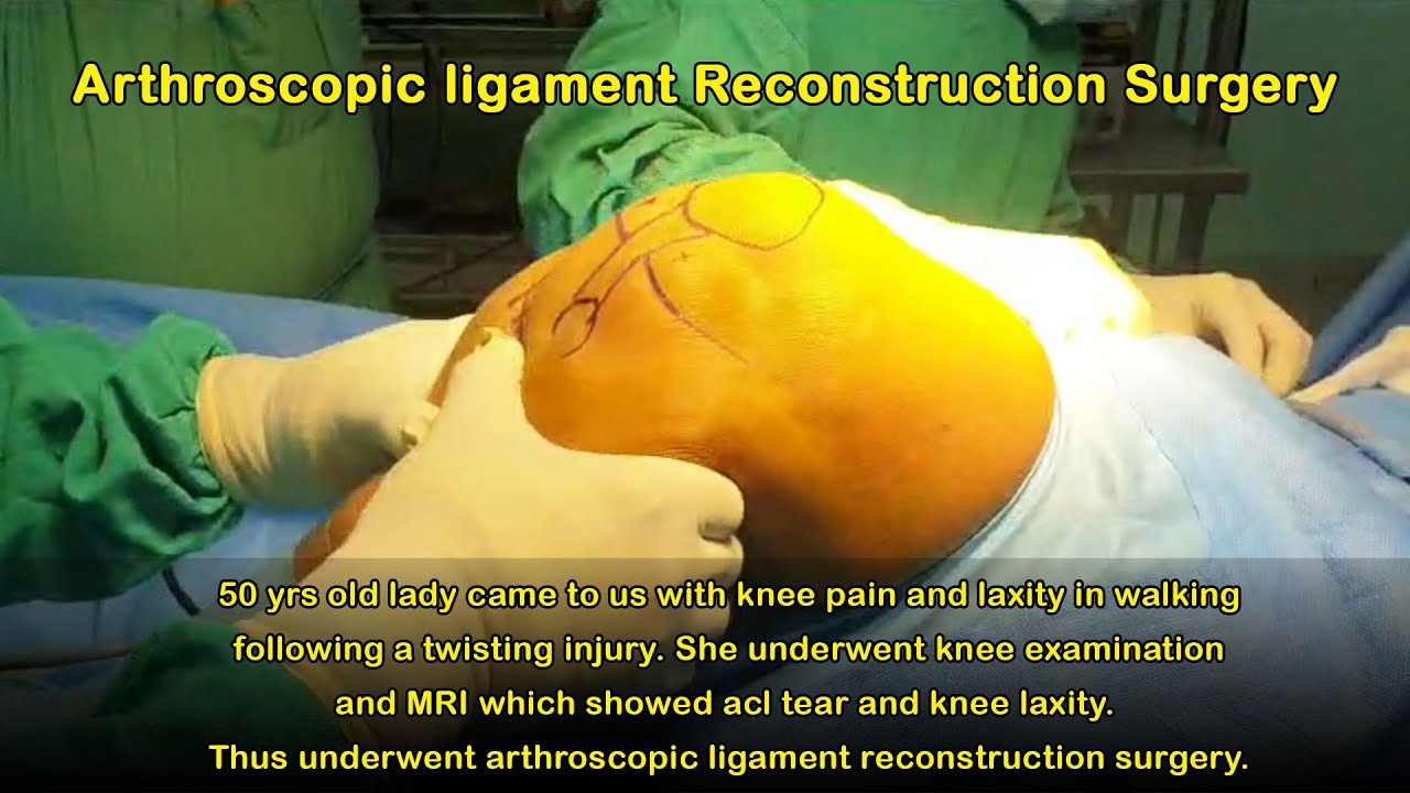 Arthroscopic ligament Reconstruction Surgery|Dr. Nikhil Verma Senior ...